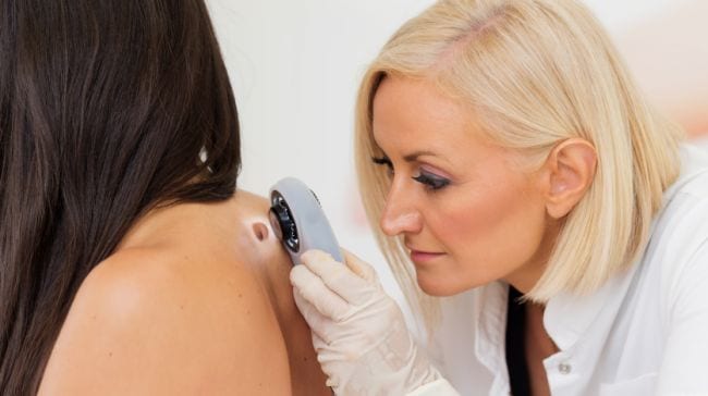 How To Detect Skin Cancer? Follow These Signs And Symptoms