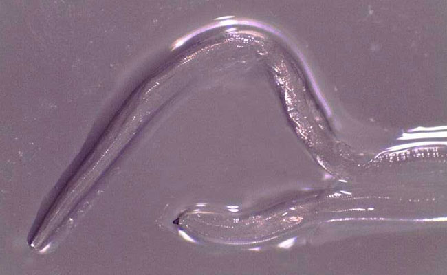 US Woman Found With Eye Worm Previously Known Only In Cattle